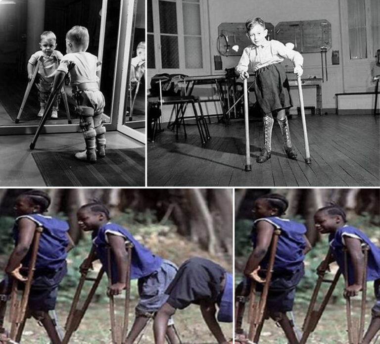 The Polio Vaccine Is 70 Years Old: From a Historic Breakthrough to ...